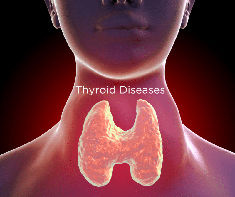 Thyroid Diseases - The Feel Good Again Institute - Lorraine Maita